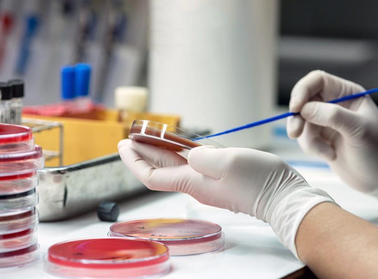 Research on antimicrobial food packaging films accelerates globally ...